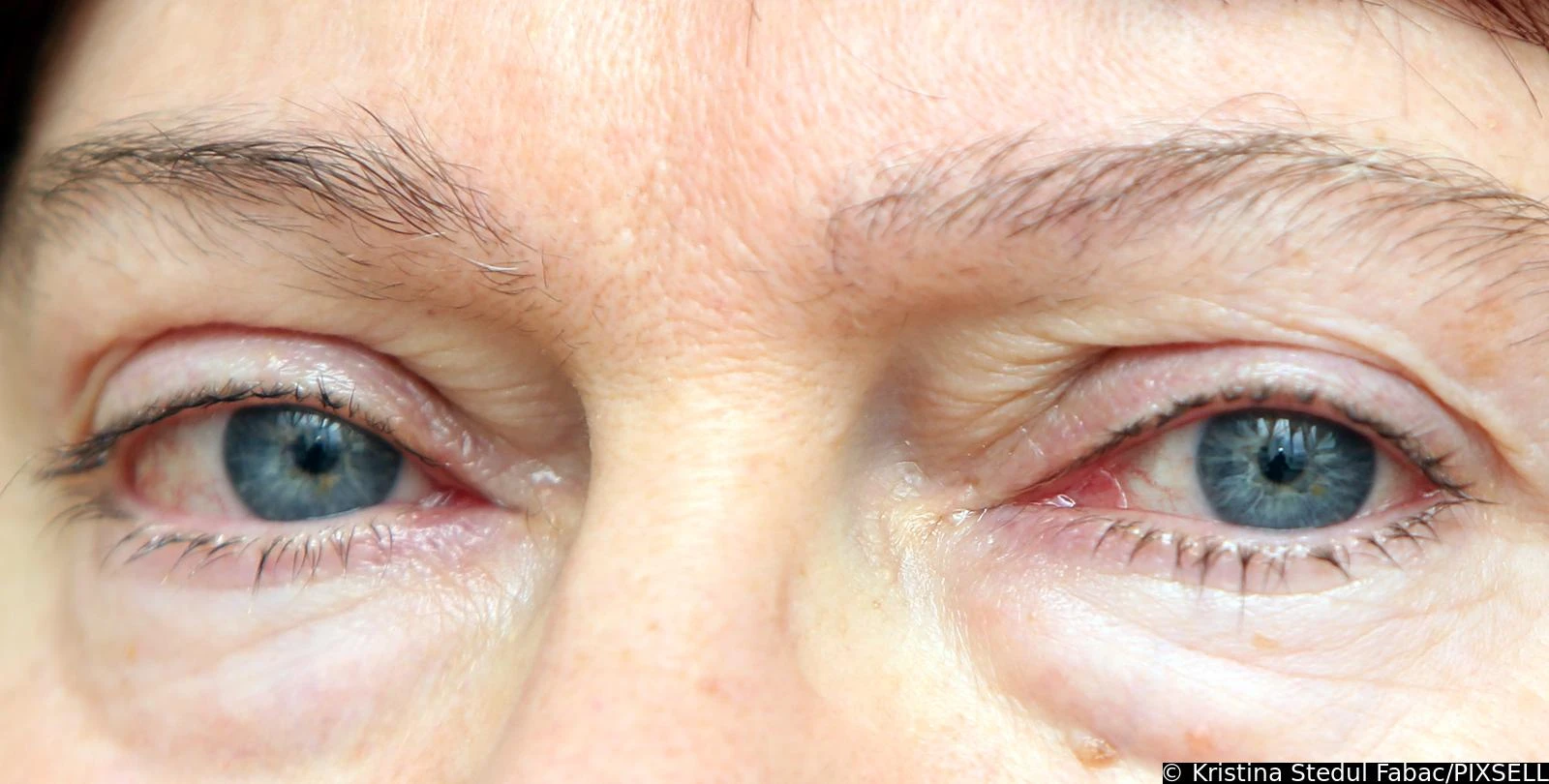 Šta znači kad nam oko (za)igra: Čekaju nas, radost, suze ili ipak nešto ...